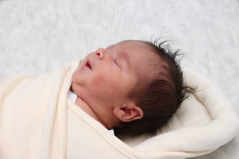 Prognosis - Birth Disorders